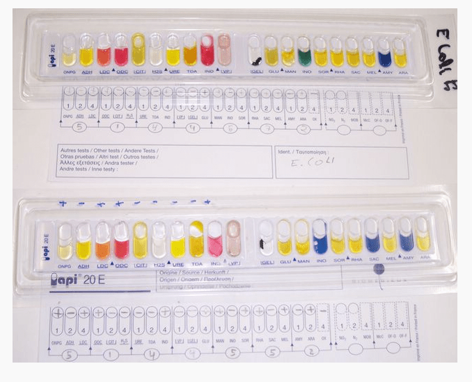 La mastitis y producción lechera; Desde una perspectiva microbiológica ...