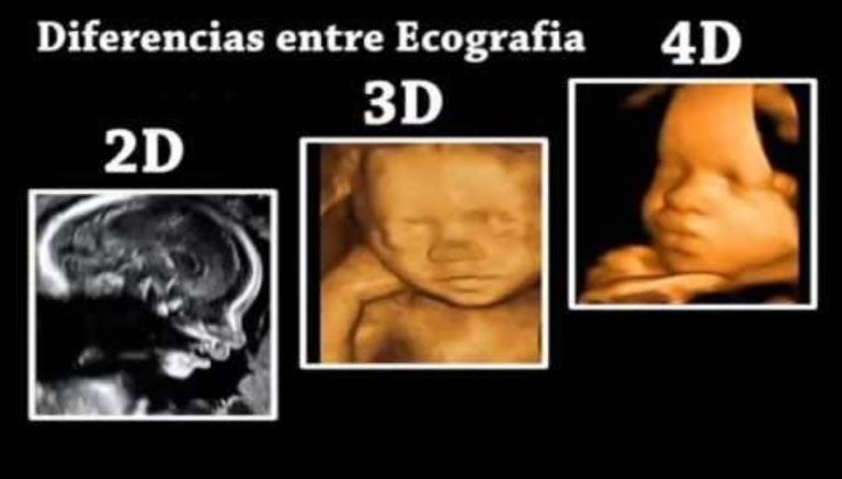 Ultrasonidos 2D, 3D y 4D ¿Cuales son sus diferencias? - GUÍAS MÉDICA