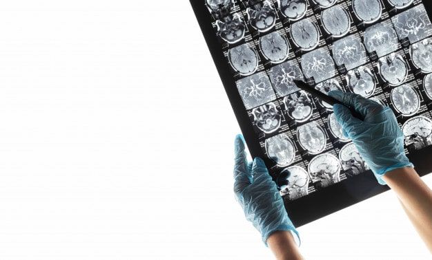 Cuando se eleva la presión dentro del cráneo - GUÍAS MÉDICA